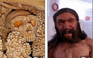 莲蓬乳是什么病_莲蓬乳照片真实吗