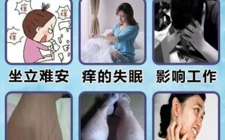 过敏吃什么药最有效果_过敏药多久见效