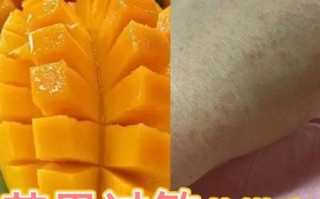 芒果过敏第几天最严重_芒果过敏症状多久达到高峰
