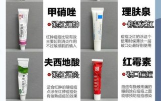 肉豆蔻酸异丙酯致痘吗_敏感肌能用吗