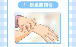 荨麻疹怎么治_5毛钱偏方真的有用吗