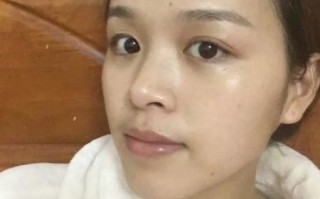 脸上擦了一个月的茶油_效果到底怎么样