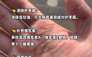 手痒怎么快速止痒_手痒止痒最简单的方法