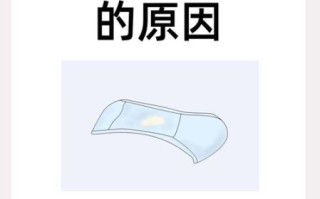 豆腐渣白带不痒没异味_需要治疗吗