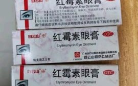 红霉素软膏和红霉素眼膏的区别_可以互相替代吗