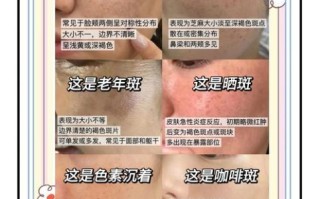 怎样祛斑最有效_祛斑方法有哪些