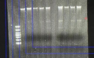 琼脂糖凝胶电泳检测dna步骤_结果怎么看