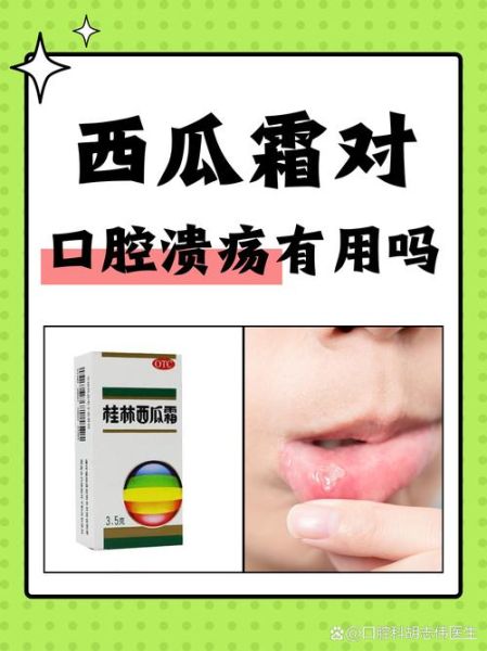 上火了吃什么降火最快_口腔溃疡吃什么好得快-第2张图片-山城妙识