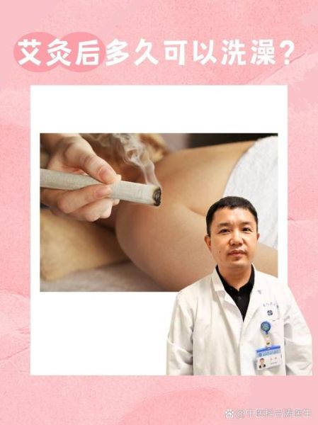 艾灸的正确方法_艾灸后多久可以洗澡-第1张图片-山城妙识 艾灸的正确方法_艾灸后多久可以洗澡-第1张图片-山城妙识