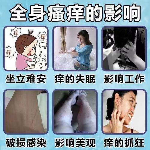 过敏吃什么药最有效果_过敏药多久见效-第1张图片-山城妙识 过敏吃什么药最有效果_过敏药多久见效-第1张图片-山城妙识