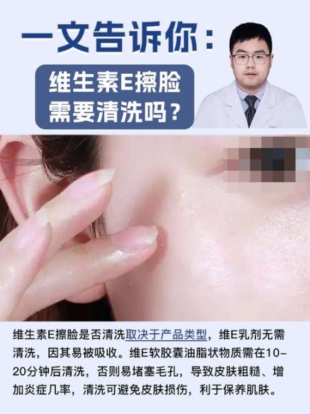 维生素e擦脸有什么副作用_用维生素e擦脸会烂脸吗-第1张图片-山城妙识 维生素e擦脸有什么副作用_用维生素e擦脸会烂脸吗-第1张图片-山城妙识