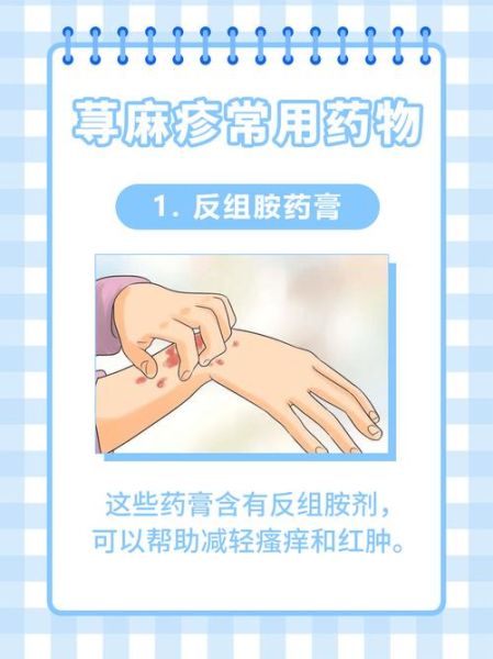 荨麻疹怎么治_5毛钱偏方真的有用吗-第1张图片-山城妙识