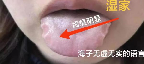 麻黄加术汤的功效与作用_麻黄加术汤适合什么人-第3张图片-山城妙识 麻黄加术汤的功效与作用_麻黄加术汤适合什么人-第3张图片-山城妙识