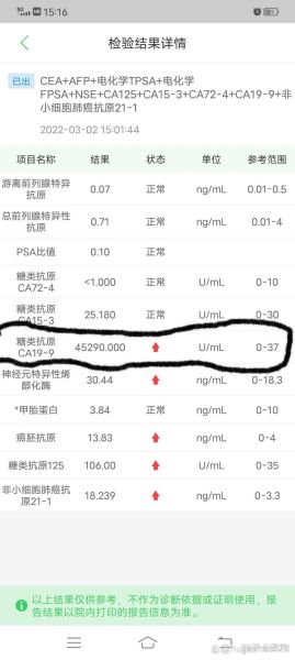 铁蛋白高是癌症吗_铁蛋白偏高怎么办-第1张图片-山城妙识 铁蛋白高是癌症吗_铁蛋白偏高怎么办-第1张图片-山城妙识