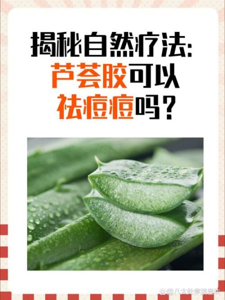 芦荟胶可以天天抹在脸上吗_长期用芦荟胶对皮肤好吗-第3张图片-山城妙识 芦荟胶可以天天抹在脸上吗_长期用芦荟胶对皮肤好吗-第3张图片-山城妙识