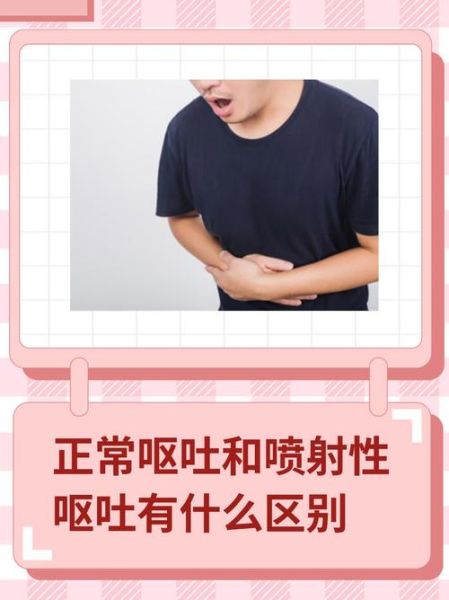 还喷射怎么办_还喷射正常吗-第1张图片-山城妙识 还喷射怎么办_还喷射正常吗-第1张图片-山城妙识