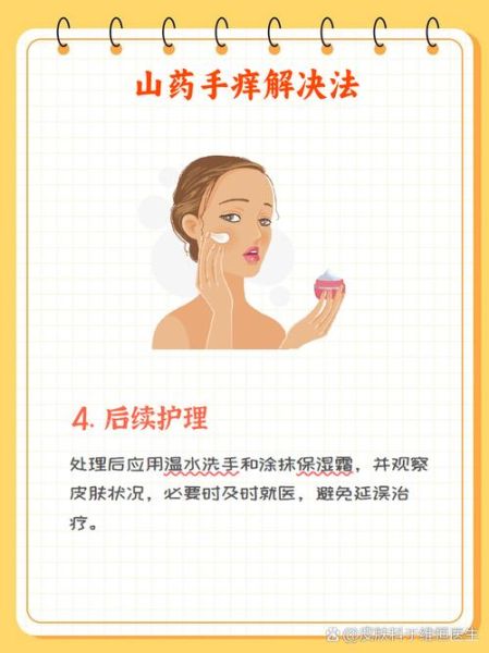 山药痒手怎么办_最有效方法-第3张图片-山城妙识