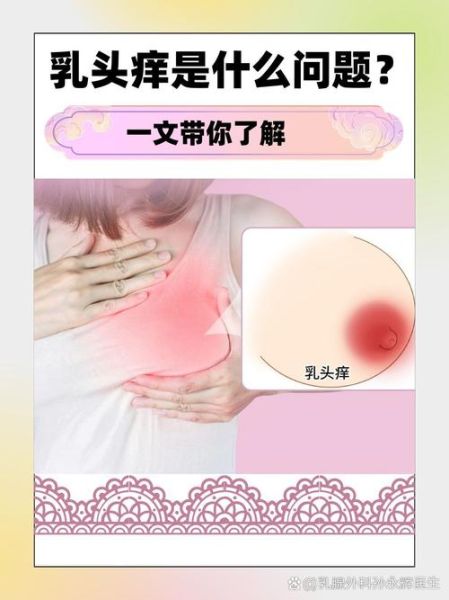 乳头痒是怎么回事_乳头疼痛怎么办-第3张图片-山城妙识 乳头痒是怎么回事_乳头疼痛怎么办-第3张图片-山城妙识