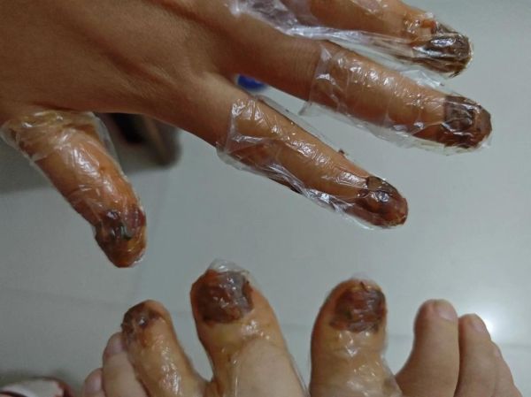 凤仙花怎么染指甲_凤仙花染指甲的正确方法-第3张图片-山城妙识 凤仙花怎么染指甲_凤仙花染指甲的正确方法-第3张图片-山城妙识