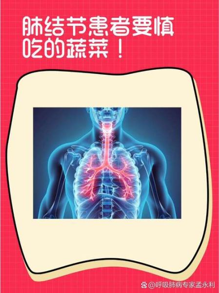 肺结节最怕的三种蔬菜是什么_如何吃才有效-第2张图片-山城妙识