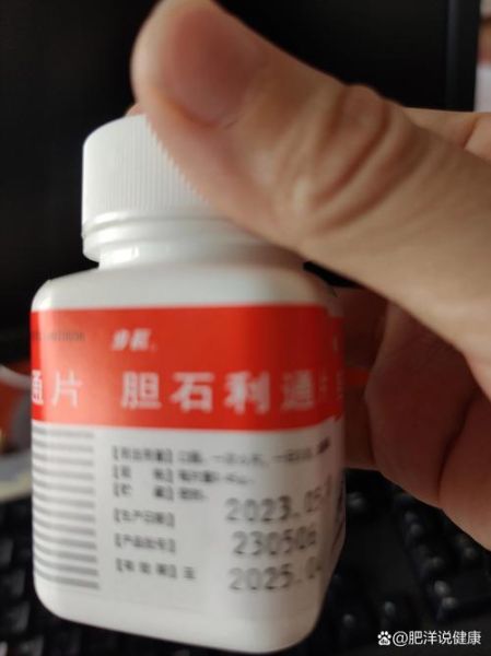 胆结石吃什么药可以化掉结石_胆结石吃什么药效果最好-第3张图片-山城妙识 胆结石吃什么药可以化掉结石_胆结石吃什么药效果最好-第3张图片-山城妙识