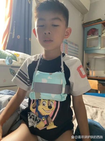 儿童鸡胸病图片_鸡胸矫正最佳年龄-第3张图片-山城妙识 儿童鸡胸病图片_鸡胸矫正最佳年龄-第3张图片-山城妙识