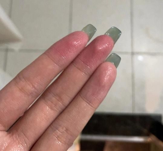 手切辣椒后5小时手还辣怎么办_辣椒素残留怎么去除-第2张图片-山城妙识 手切辣椒后5小时手还辣怎么办_辣椒素残留怎么去除-第2张图片-山城妙识