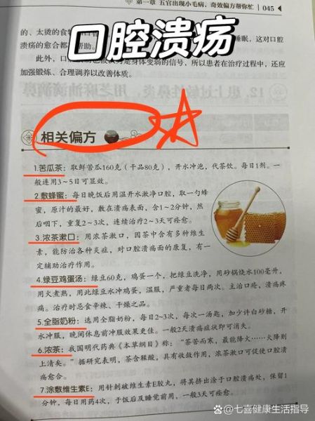 口腔溃疡怎么办最快愈合_小偏方真的有用吗-第2张图片-山城妙识 口腔溃疡怎么办最快愈合_小偏方真的有用吗-第2张图片-山城妙识