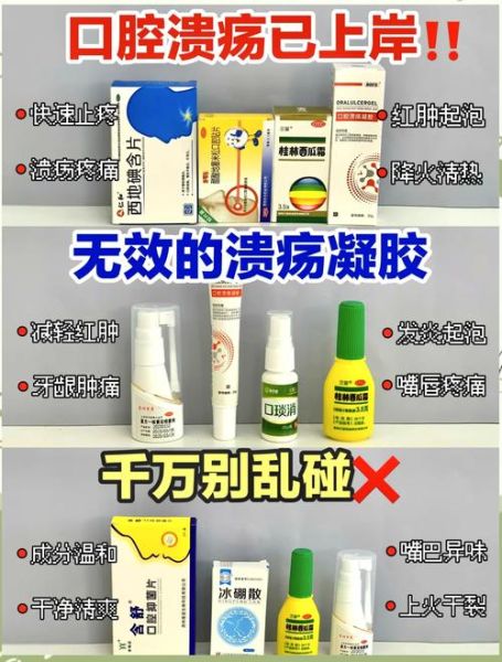 口腔溃疡怎么办最快愈合_小偏方真的有用吗-第1张图片-山城妙识 口腔溃疡怎么办最快愈合_小偏方真的有用吗-第1张图片-山城妙识